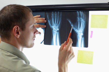 Broken Thumb: Treatment, Symptoms, Diagnosis and Causes - The Health ...